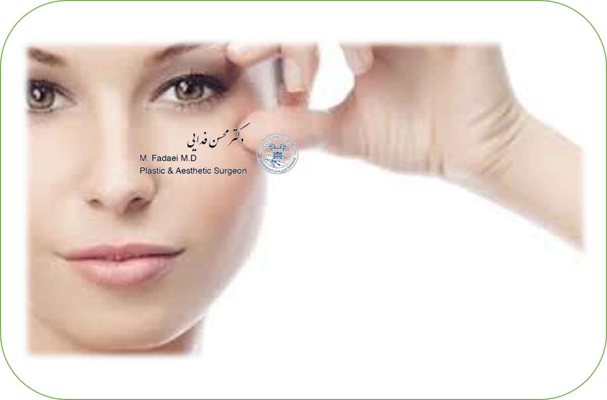 temple lift - Everything About TEMPLE LIFT Surgery - Dr.Mohsen Fadaei