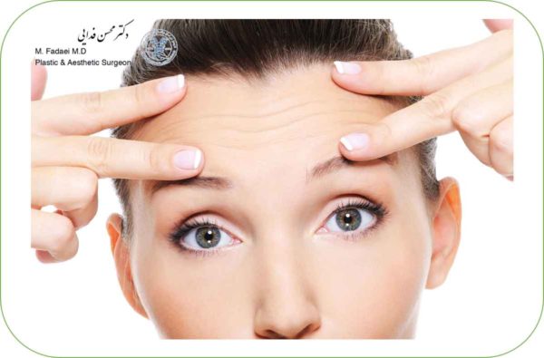 temple lift - Everything About TEMPLE LIFT Surgery - Dr.Mohsen Fadaei