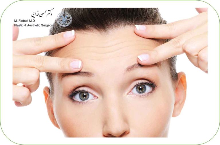 temple lift - Everything About TEMPLE LIFT Surgery - Dr.Mohsen Fadaei